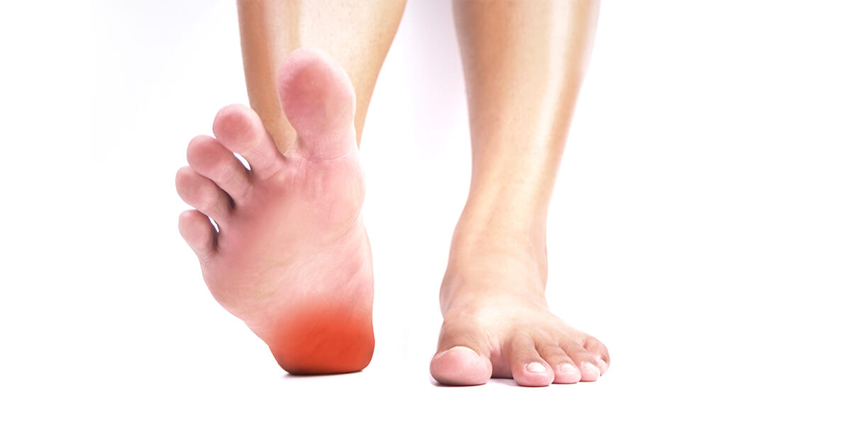 Uso de cinta de kinesiología para la fascitis plantar y el dolor de pies
